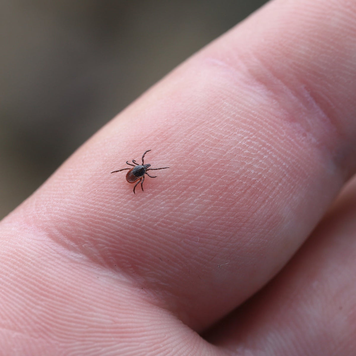 Everything About Tick Bites: Prevention, Treatment & Disease Protection ...